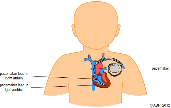 The prevention and treatment of cardiovascular diseases